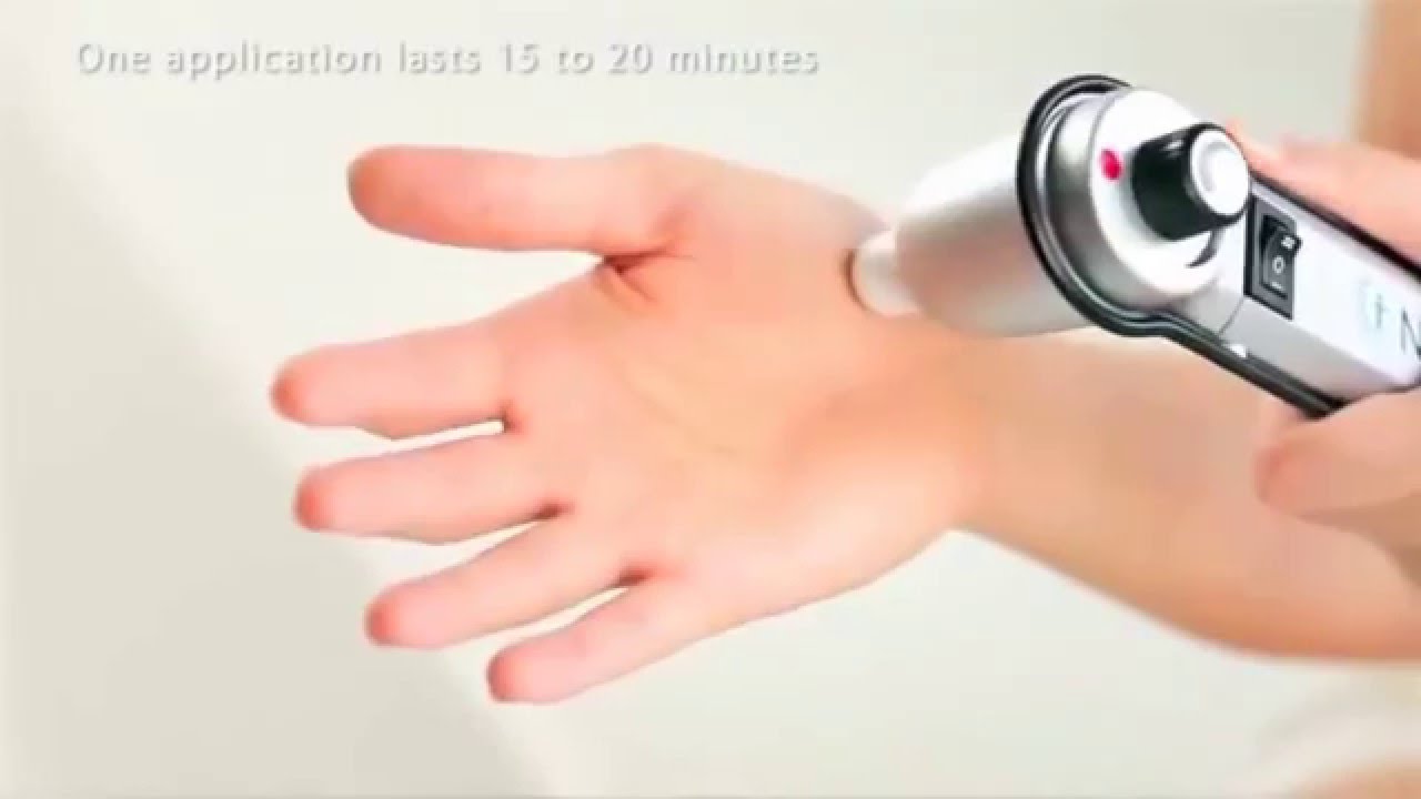 Novafon Nostrafon et arthrose - YouTube