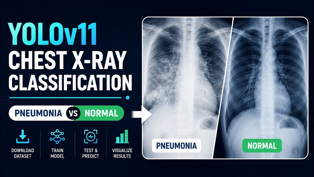 Chest X-Ray Classification using YOLOv11 | Pneumonia vs Normal ...