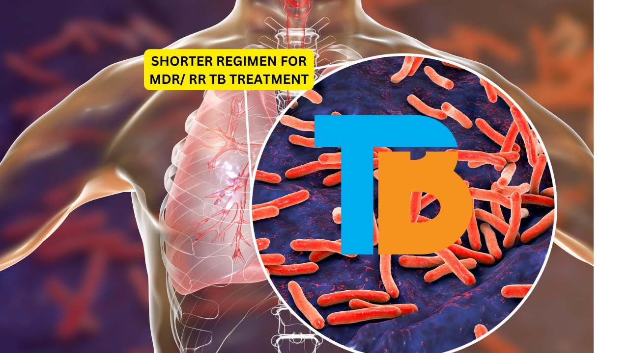 Exploring the new WHO treatment guidelines for MDR/ RR TB - YouTube