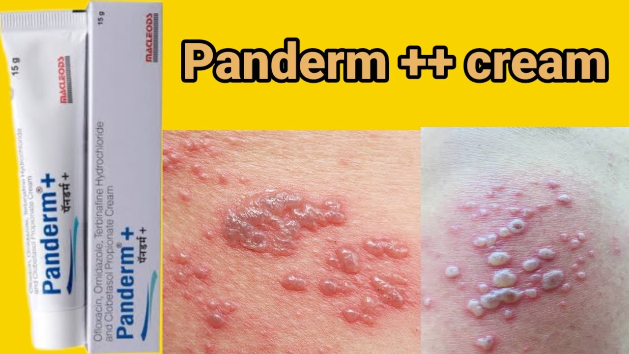 Panderm ++ Cream || All type of skin allergy || #medicinesknowledge ...