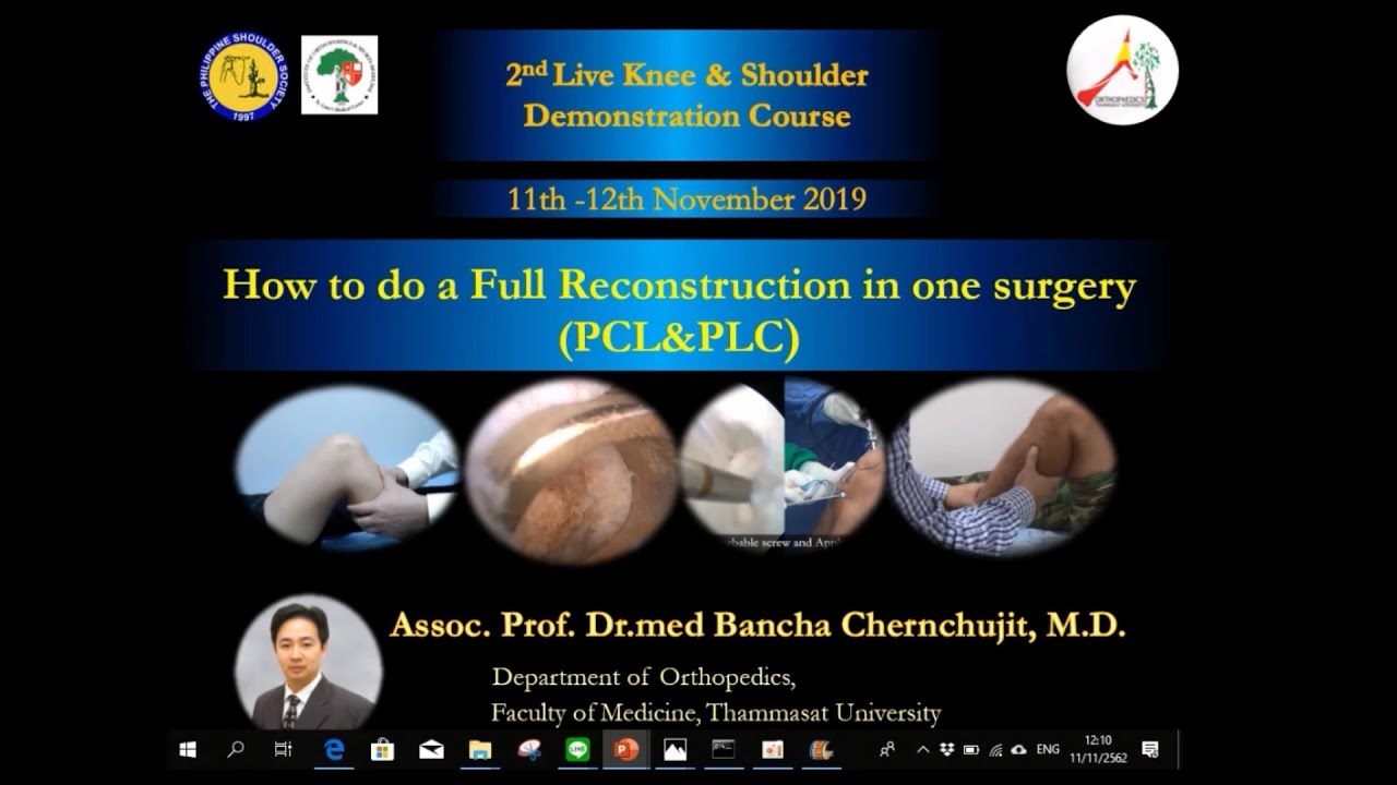 KneeDislocation PCL-PLC Reconstructionผ่าตัดเอ็นไขว้หลังเอ็นข้าง ...