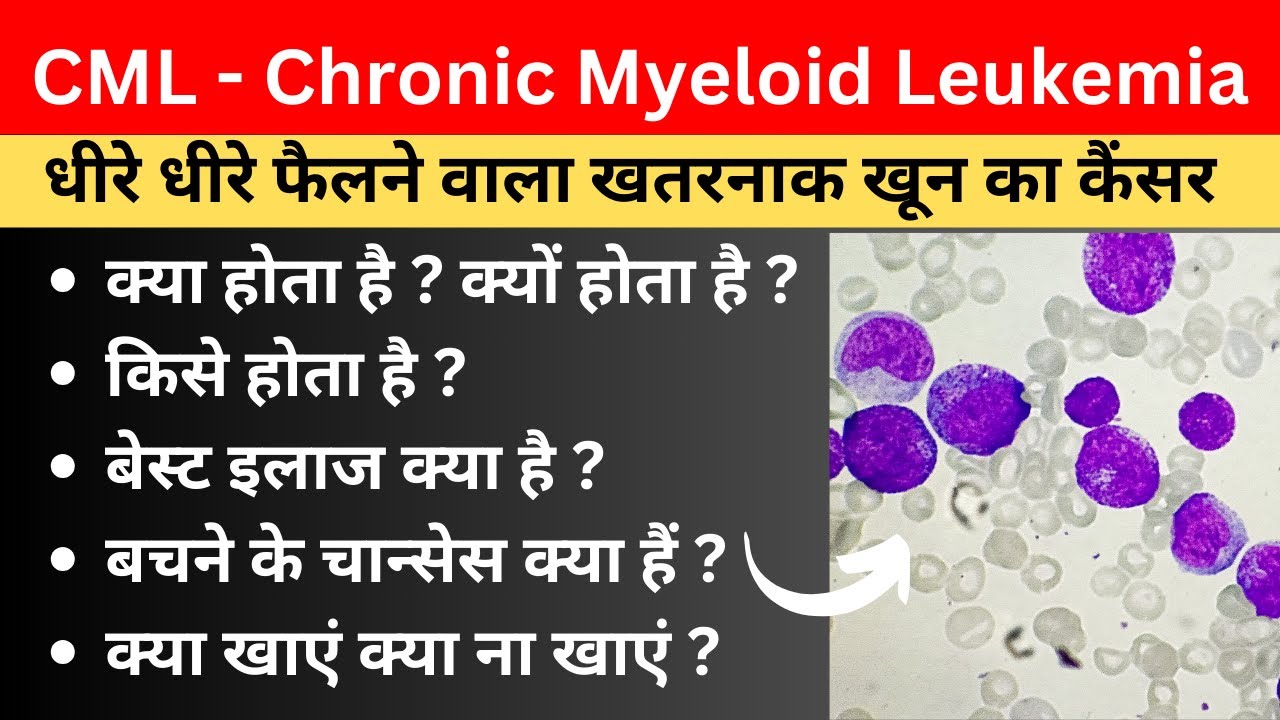 CML in hindi | Chronic Myeloid Leukemia | CML क्या होता है ? treatment ...