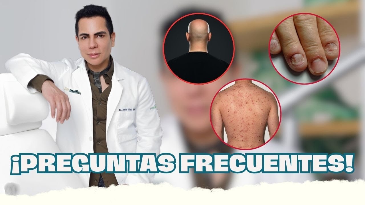 RESPONDO TODO SOBRE LA PIEL, PELO Y UÑAS I JAVIER DERMA - YouTube