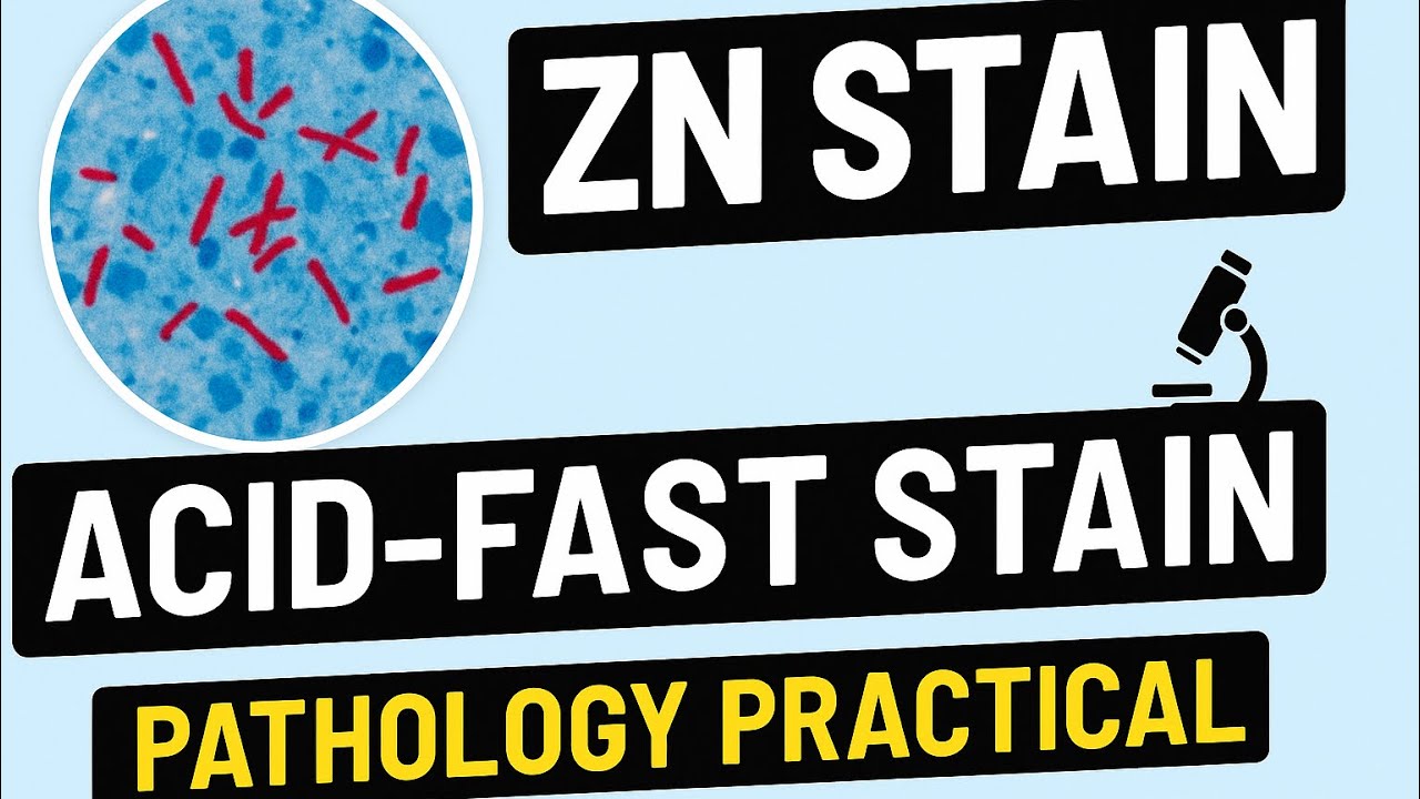 Ziehl-Neelsen (ZN) Staining | Acid-Fast Stain | TB Diagnosis in ...