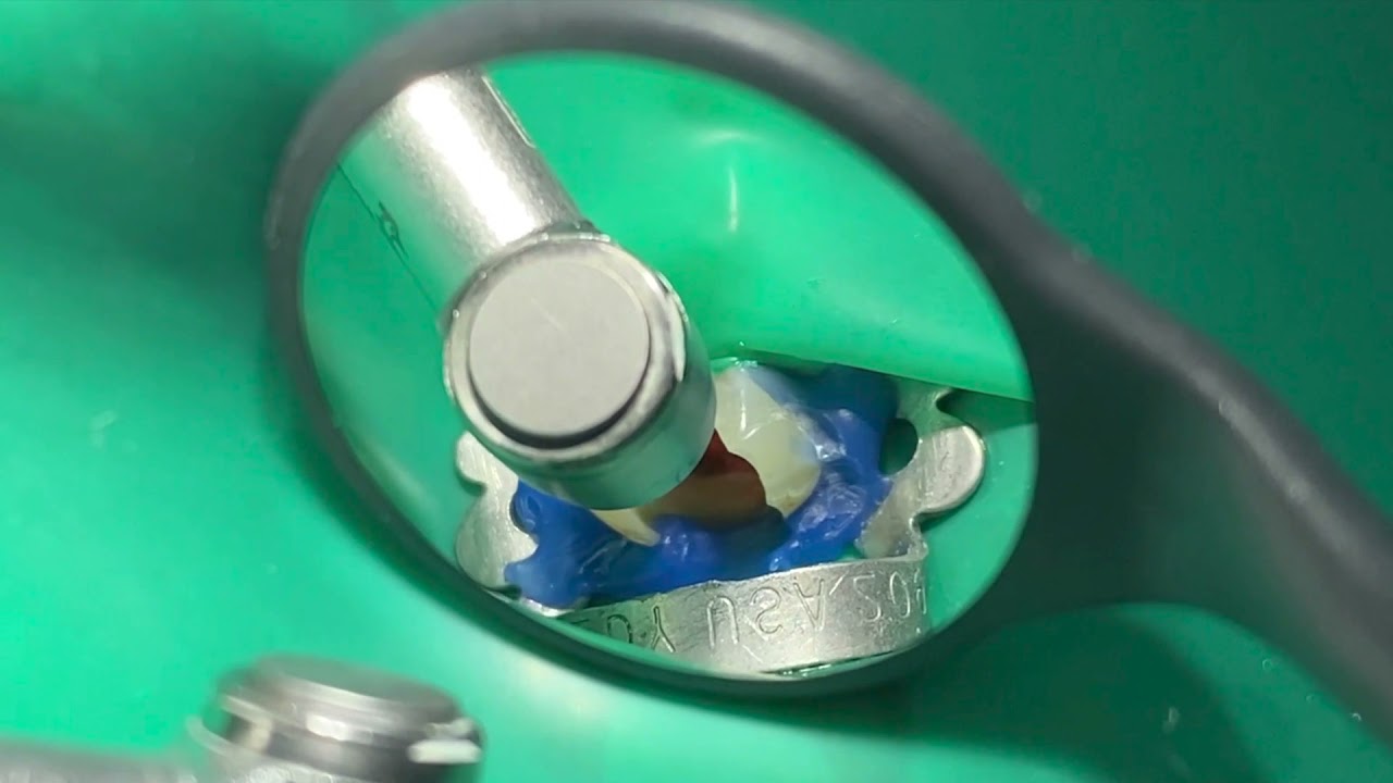 2 Starter File for Coronal Flaring - YouTube