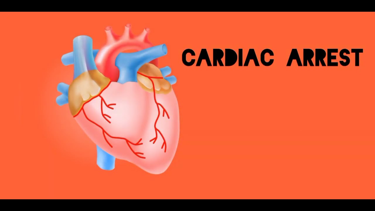Cardiac Arrest Animation Youtube