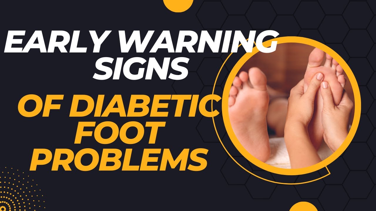 Early Warning Signs of Diabetic Foot Problems - YouTube