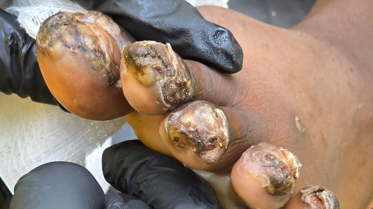 John Nabuule's jiggered again - subscribe @riseupsociety.net for 1000s ...