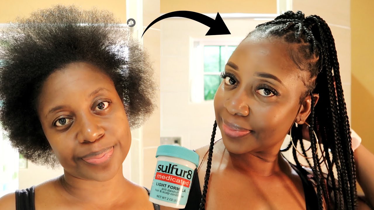 I’M BACK! DIY boneless/knotless braids| SCALP PSORIASIS| Sulfur 8 ...