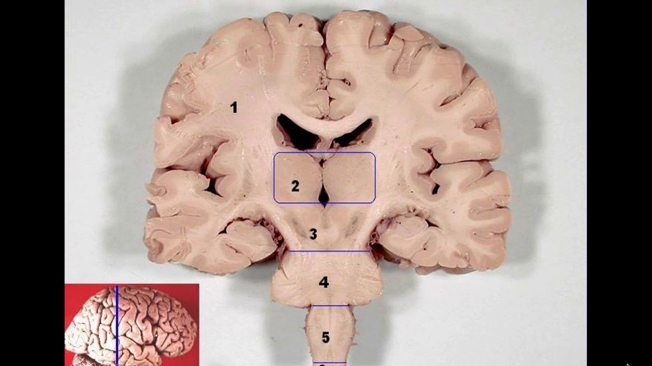 Disorders of Motor Function part 1 - YouTube