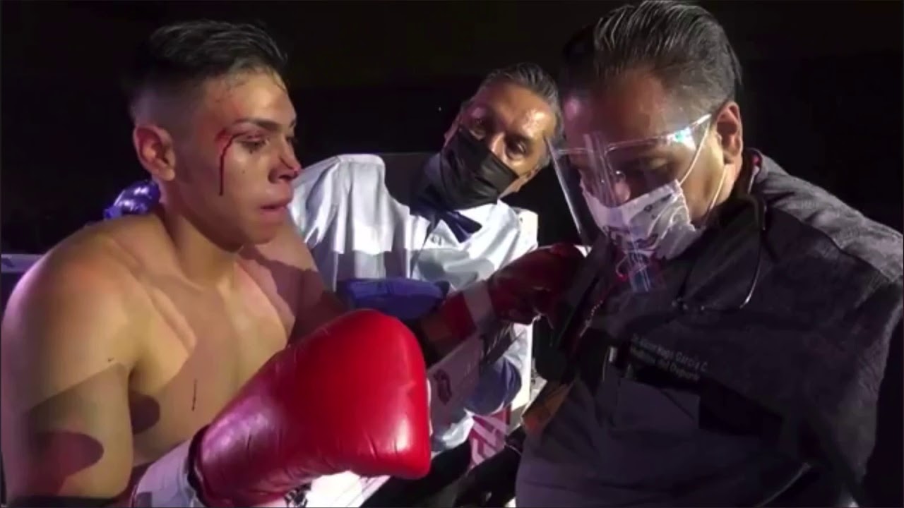 Matt Zilch vs Nahoma Hernandez - YouTube