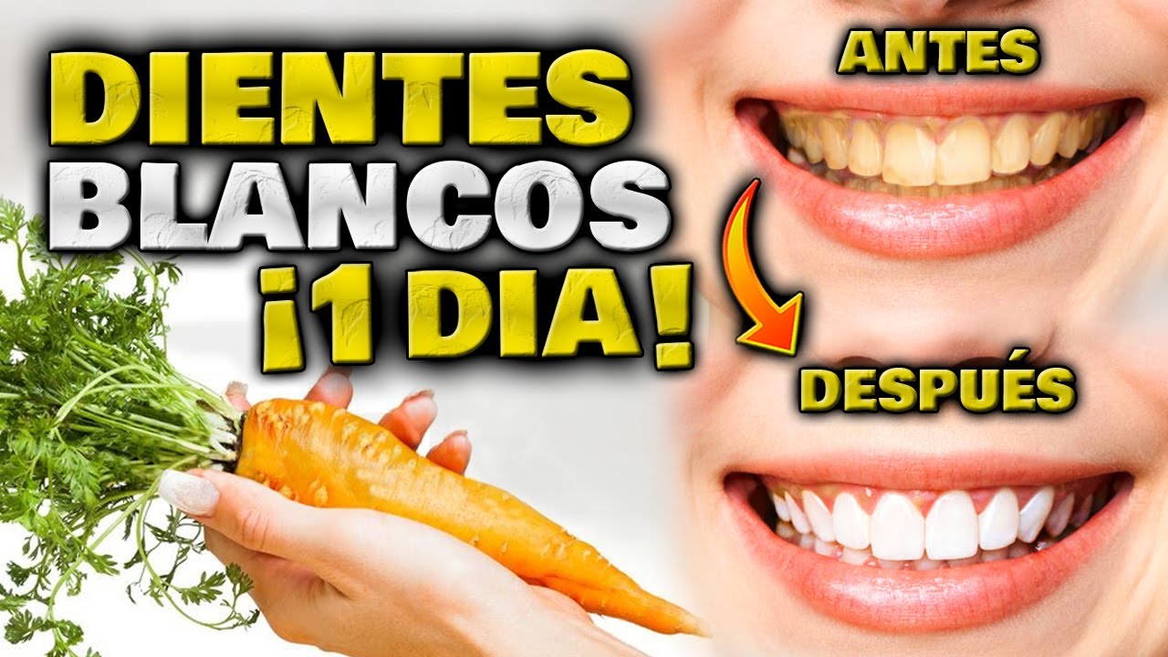 DIENTES BLANCOS y PERFECTOS en 2 MINUTOS!! Cómo Blanquear los Dientes ...