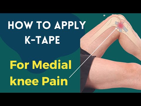 How to treat Knee Pain - Medial Collateral Ligament (MCL) - Kinesiology ...