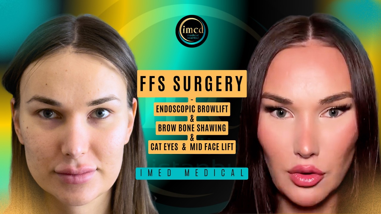 iMed Medical Videos - iMed Medical