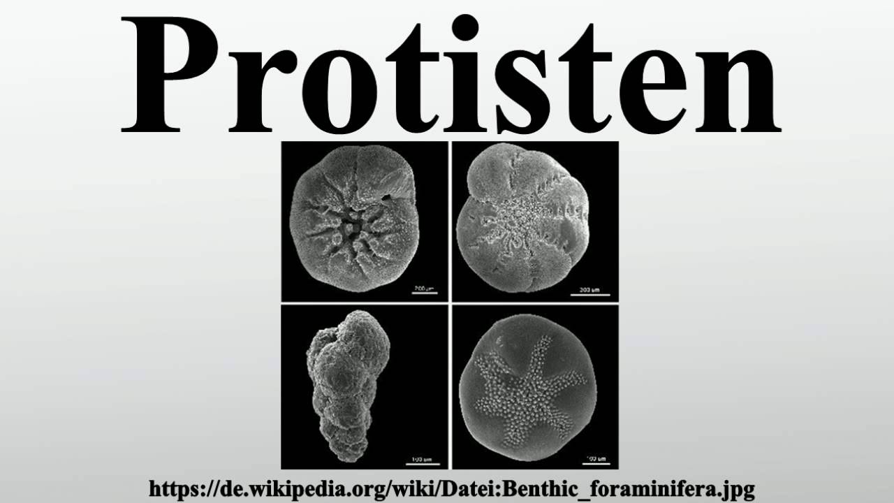 Protista Algen Nachlese 09: Unbestimmte Desmidiaceen Und Andere Algen