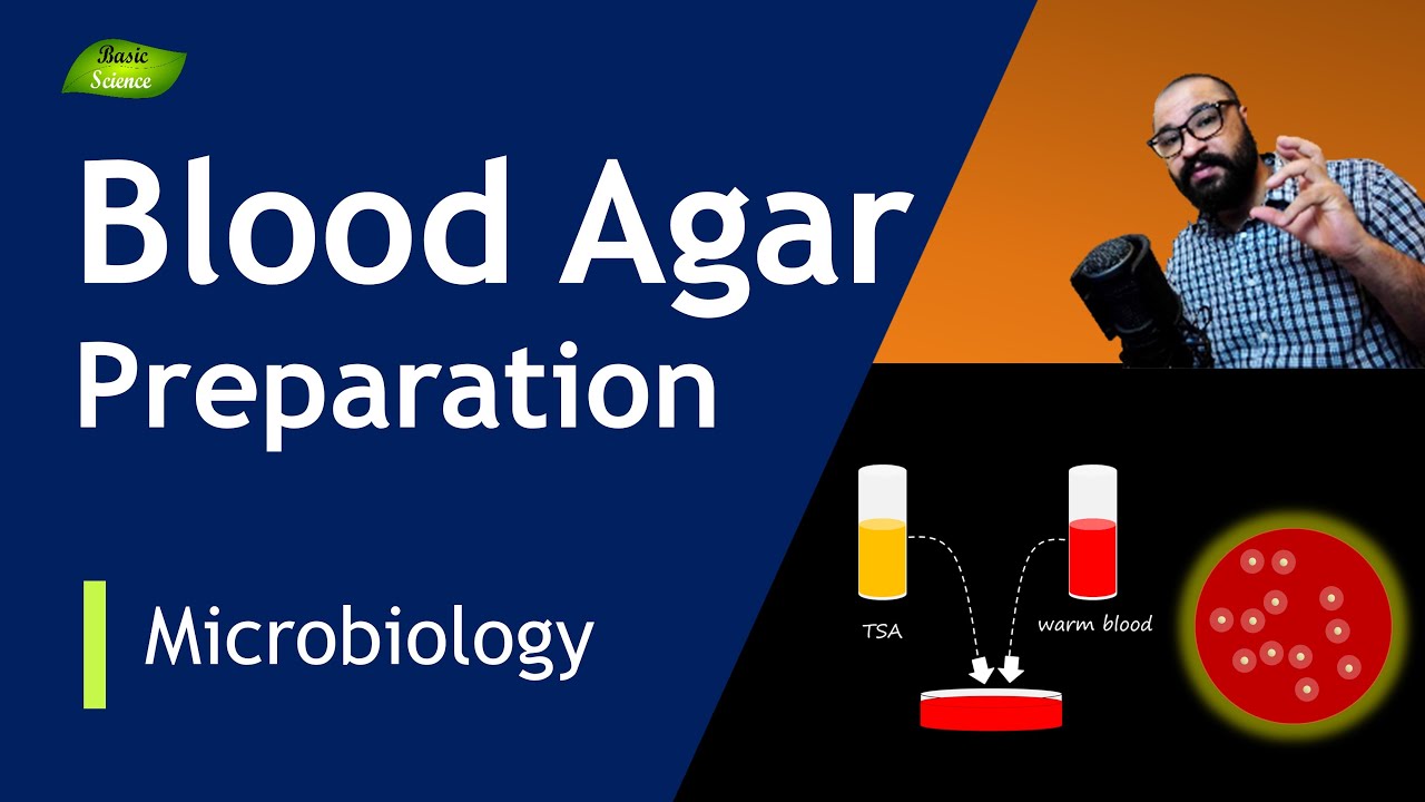 How to Prepare Blood Agar | Media Microbiology Lab | Hemolysis ...