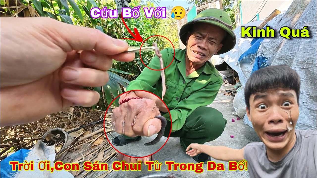 Kinh Quá, Phát Hiện Bố Bị Con Sán Chui Ra Từ Trong Da Nhìn Rất Đáng Sợ ...