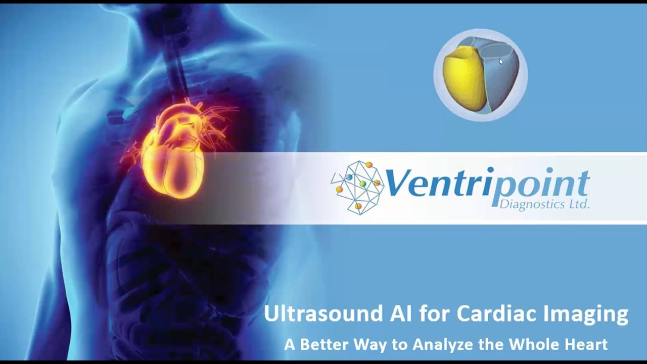 Technology Showcase: Introduction to Ventripoint's VMS+ for Cardiac ...
