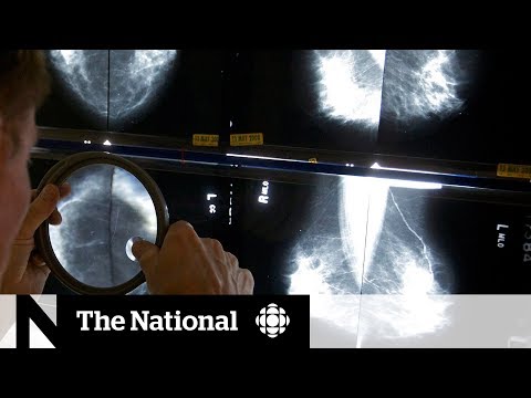 MRIs of dense breasts find more cancer, false positives