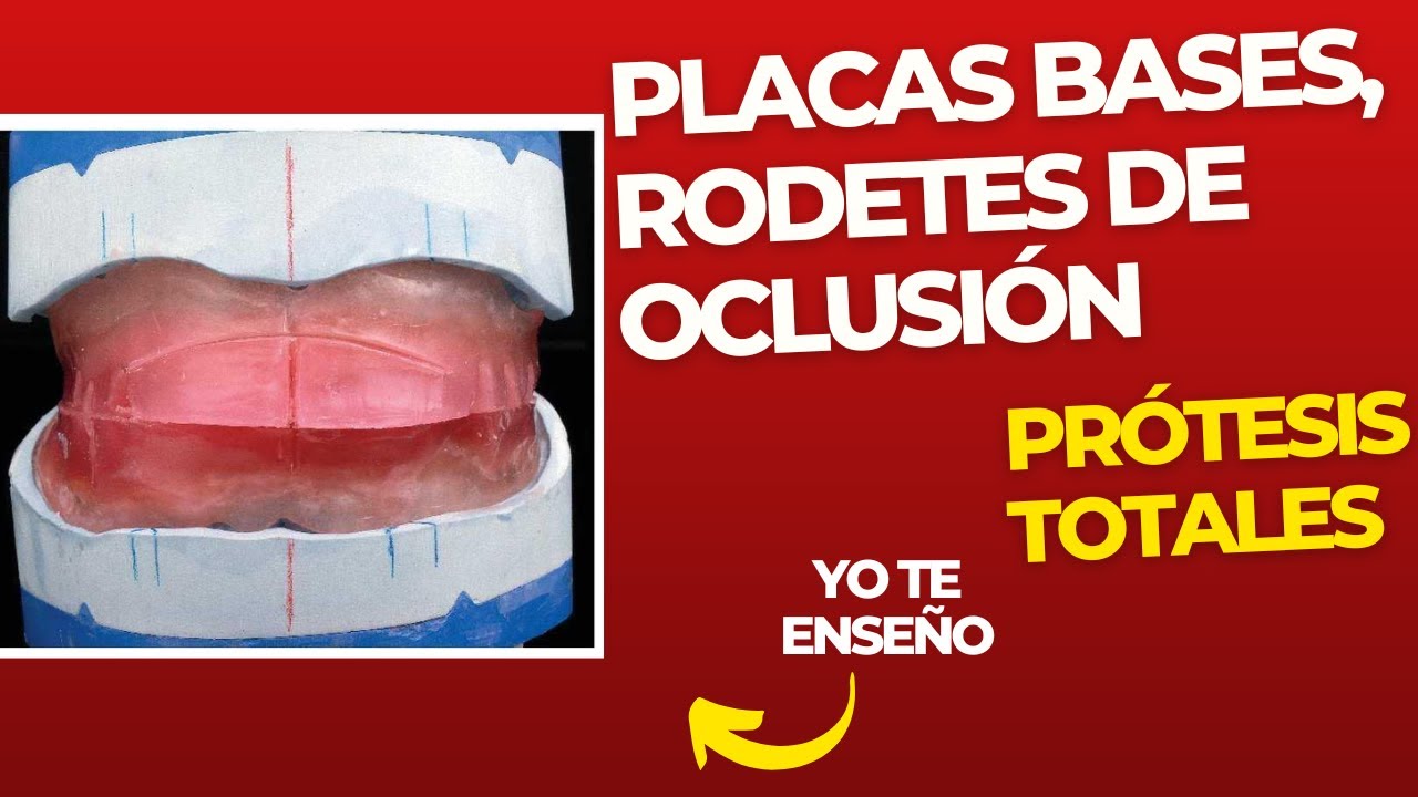 Placas bases, rodetes de oclusión y contorno 👅 PASOS Prácticos # ...