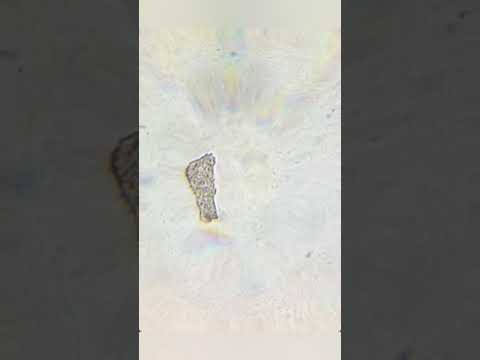 Beetroot under microscope 🔬 - YouTube