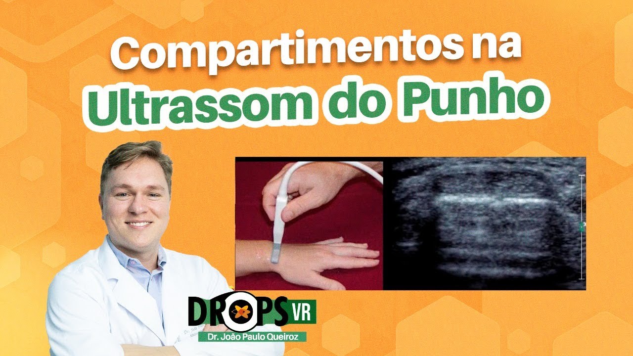 COMO IDENTIFICAR OS COMPARTIMENTOS NA ULTRASSOM DO PUNHO? I VOCÊ ...