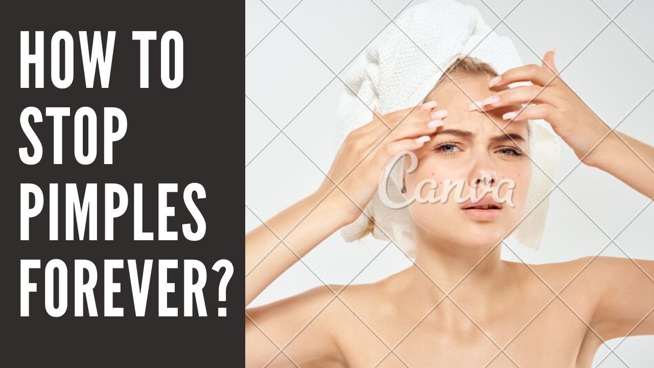 How to Stop Pimples Forever - Pimple Popping | STEPAhead - YouTube