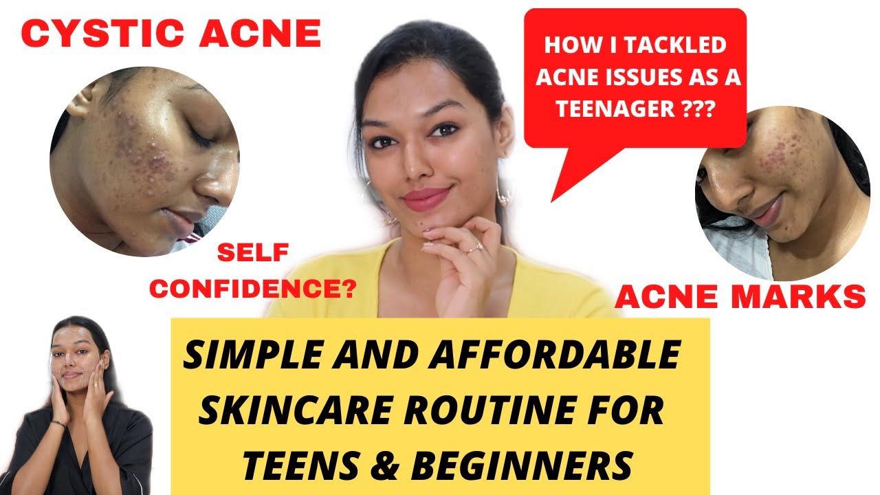 How to start Skincare Routine for Teenagers/Beginners|Simple Effective ...