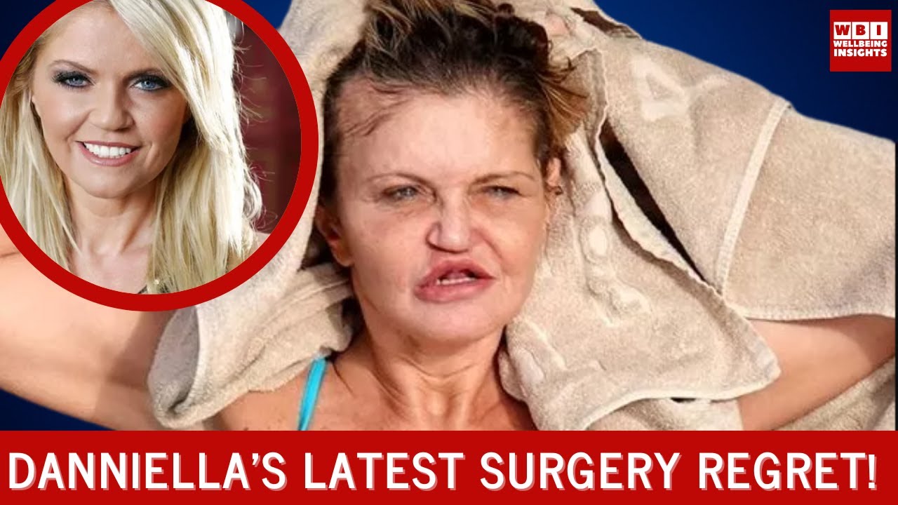 The Shocking Aftermath of Danniella Westbrook's Recent Nose Surgery ...