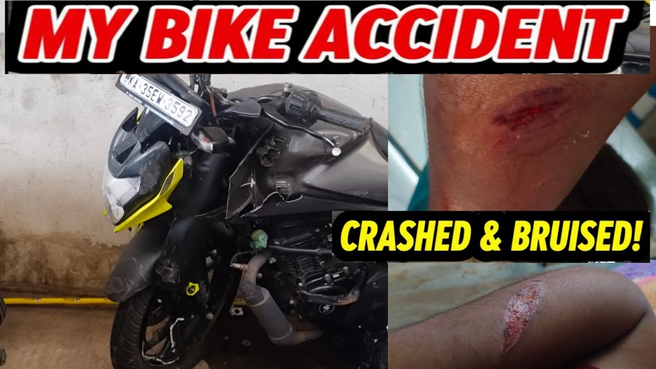 My bike accident 😔CRASHED & BRUISED, ನಾನು ಊಹೆ ಕೂಡ ಮಾಡಿರಲಿಲ್ಲ ಹೀಗೆ ...