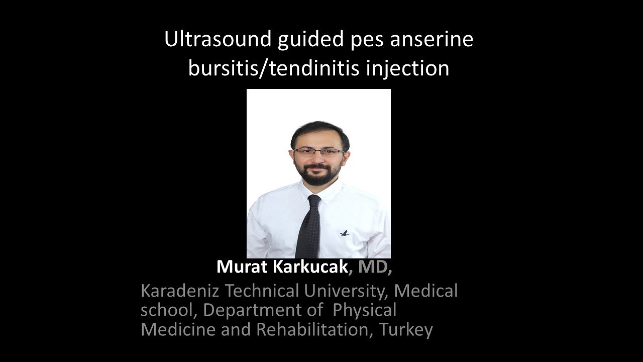 Ultrasound guided pes anserine bursitis/tendinitis injection - YouTube
