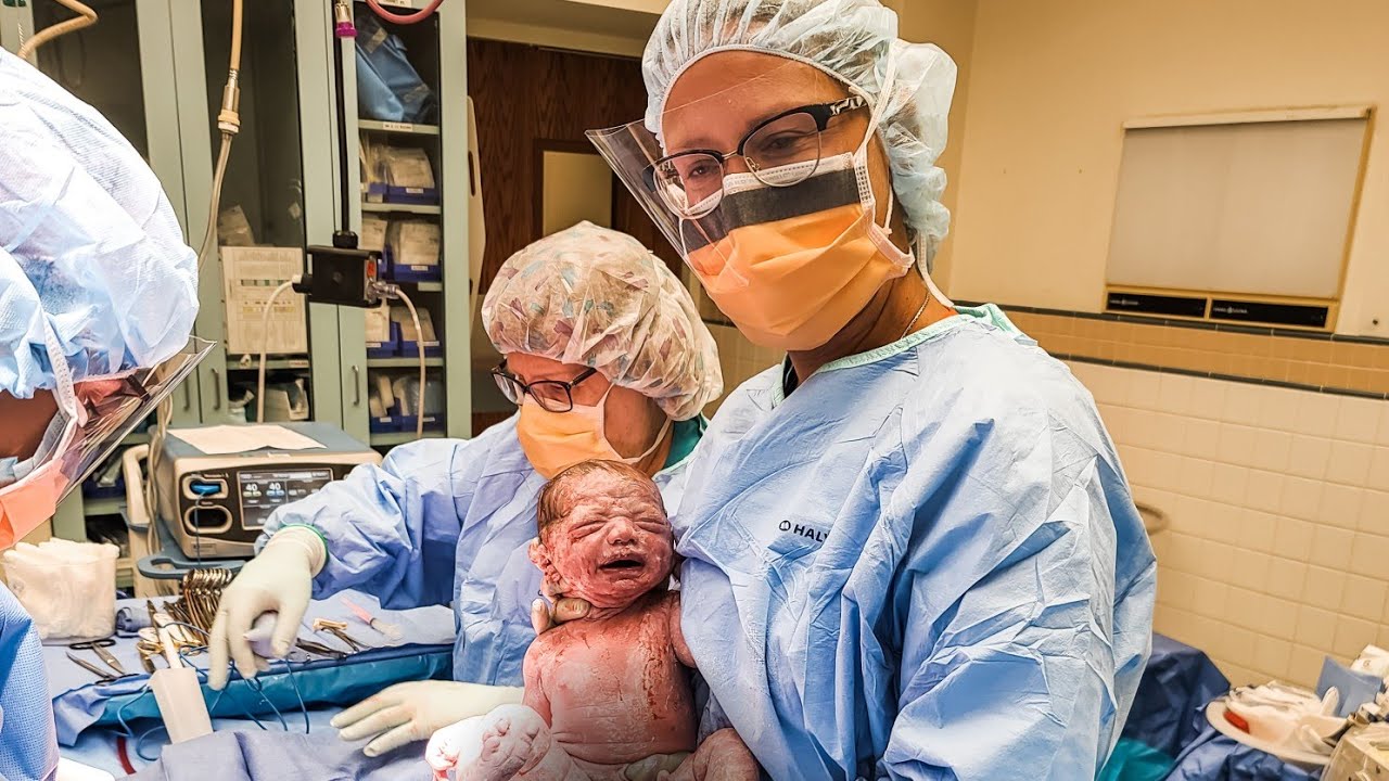 Graphic Childbirth Photos