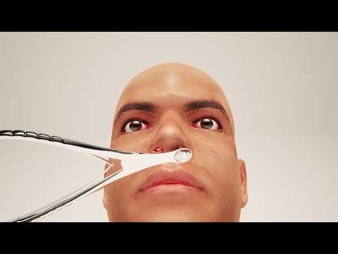 LED Nasal Speculum by VT
