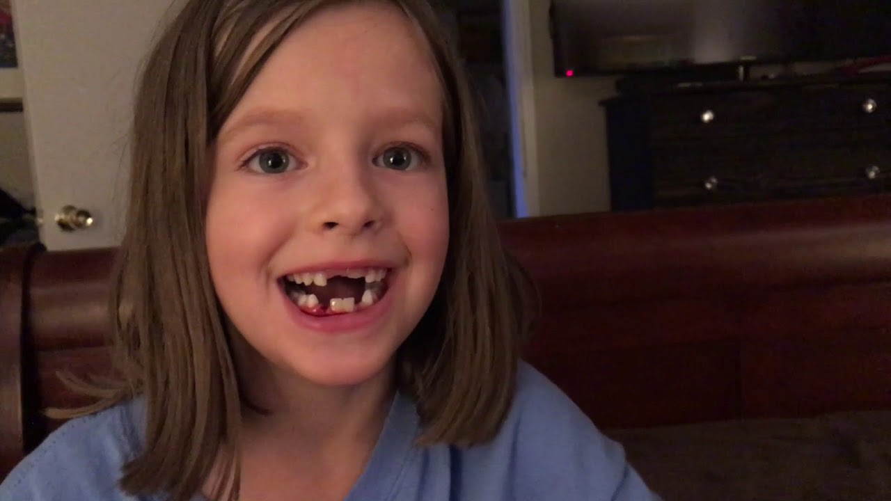 The 6 yr Old Pulls Her Tooth Out - YouTube