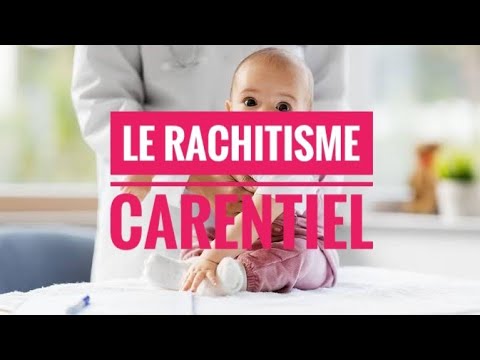 Le Rachitisme Carentiel - partie 01 (Physiologie) - YouTube