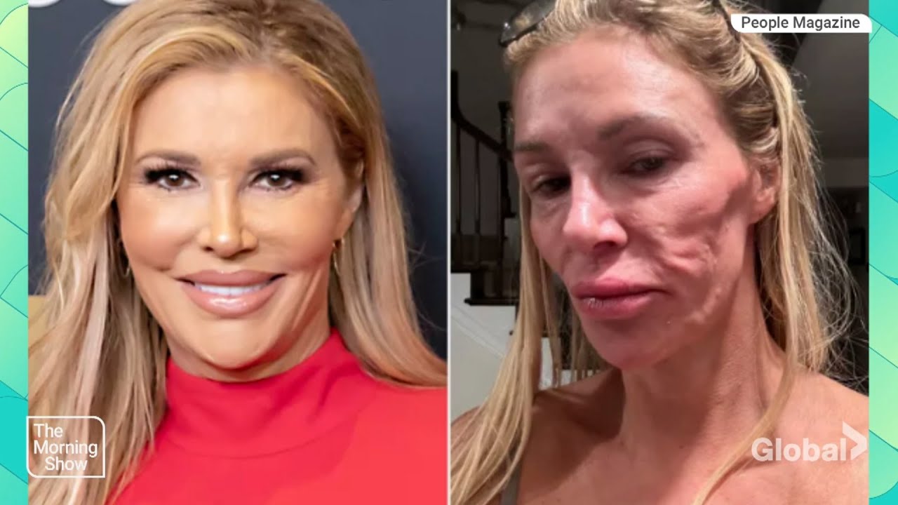 A doctor's insight on the 'Real Housewife' fighting facial parasites ...