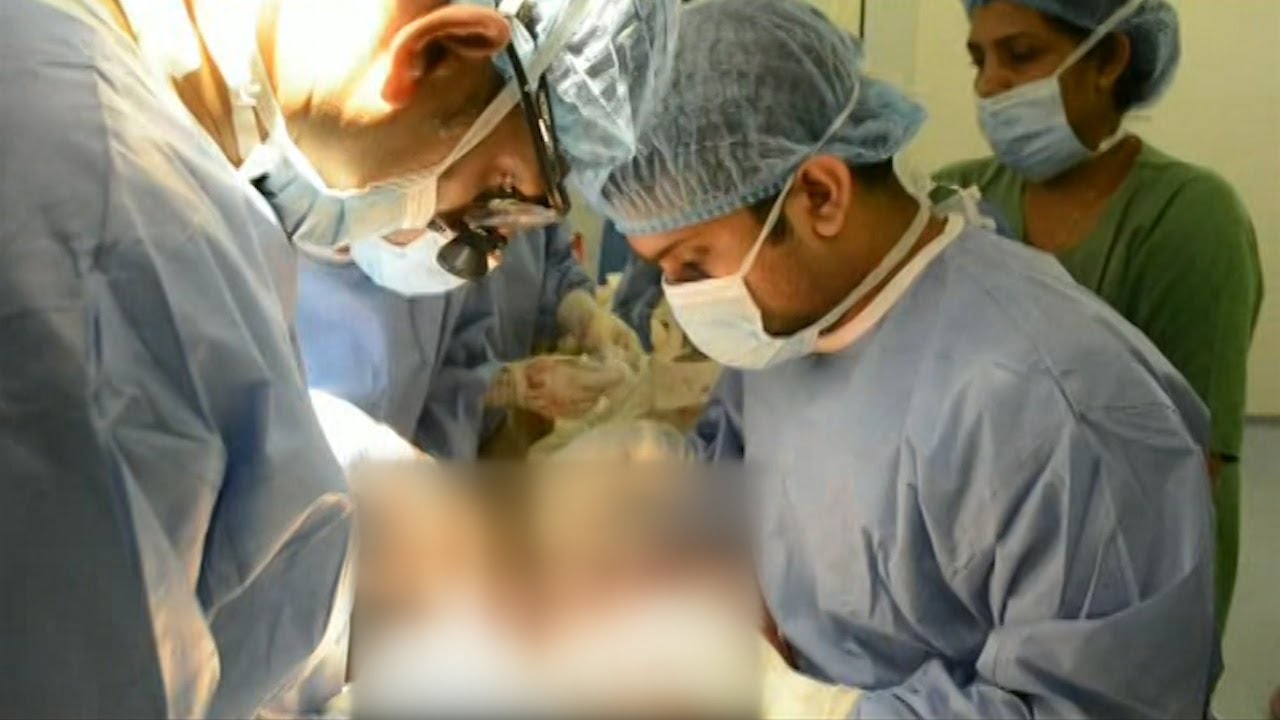 Sri Lanka performs first-ever leg transplant - YouTube