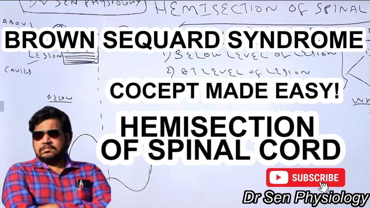 Brown Sequard Syndrome-Hemisection of spinal cord - YouTube