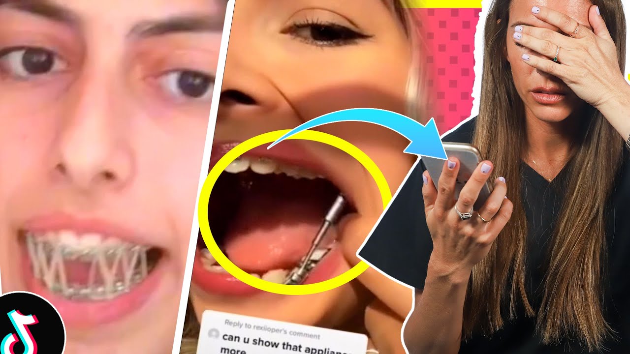 🧨Dentista REACCIONA a VIRALES de TIKTOK (y te explica COSITAS MUY ...