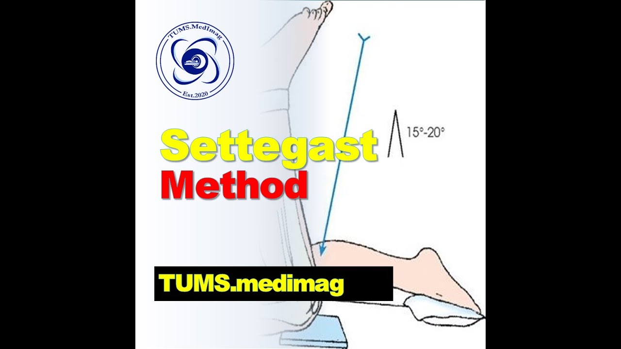 Medimag: Patella and Patellofemoral Joint, Settegast Method - YouTube