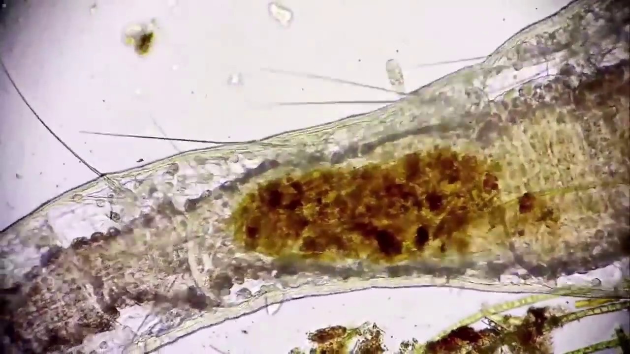 Mikroskop Aufnahmen von Mikroorganismen sehr entspannend - YouTube