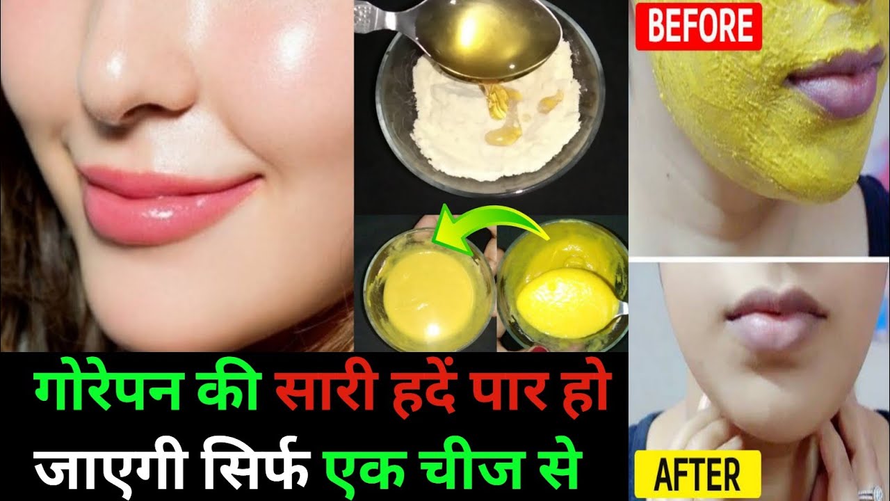 Face pack with Besan for Glowing Skin |besan face pack for pimples ...