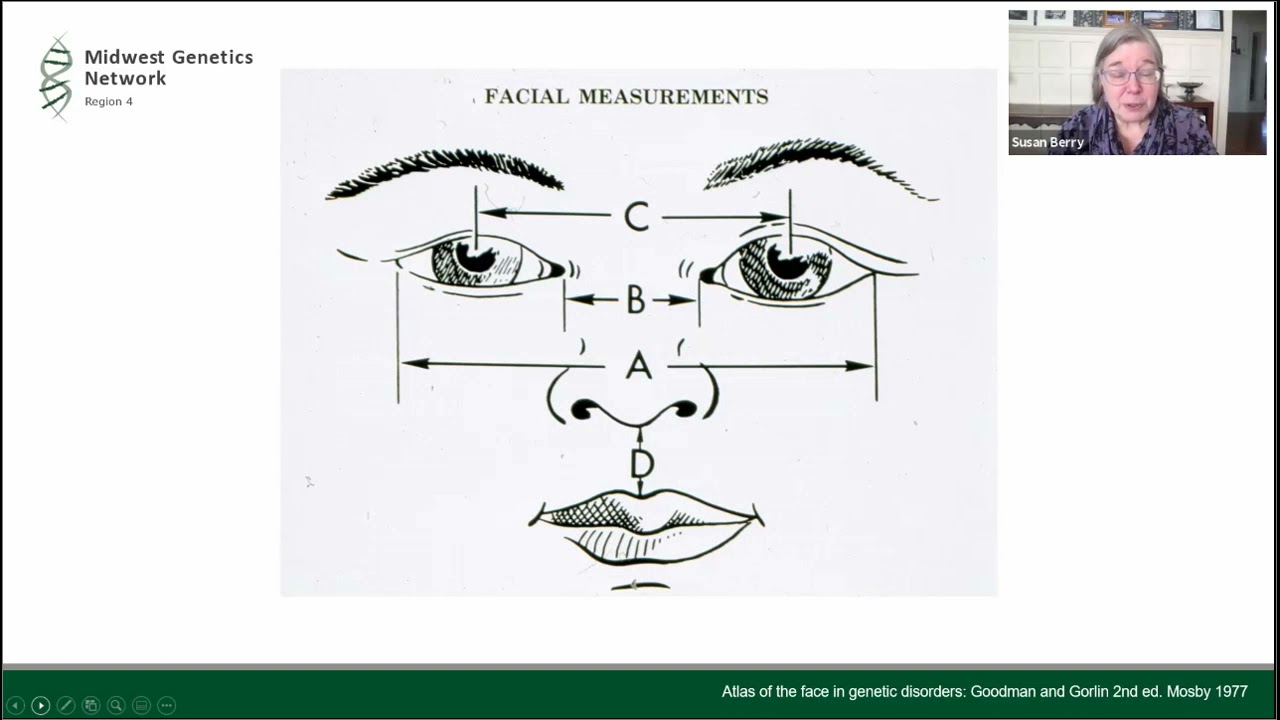 VLC 3: Dysmorphology 101 Using your Observation Skills - YouTube