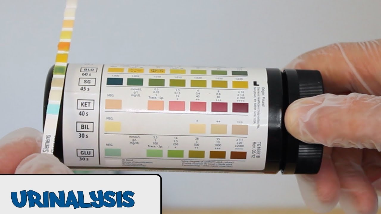 Urine Dipstick Test Principle Procedure Results YouTube urine-dipstick-test-principle-procedure-results-youtube