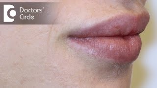 What Are The Little White Spots On My Lips | Lipstutorial.org