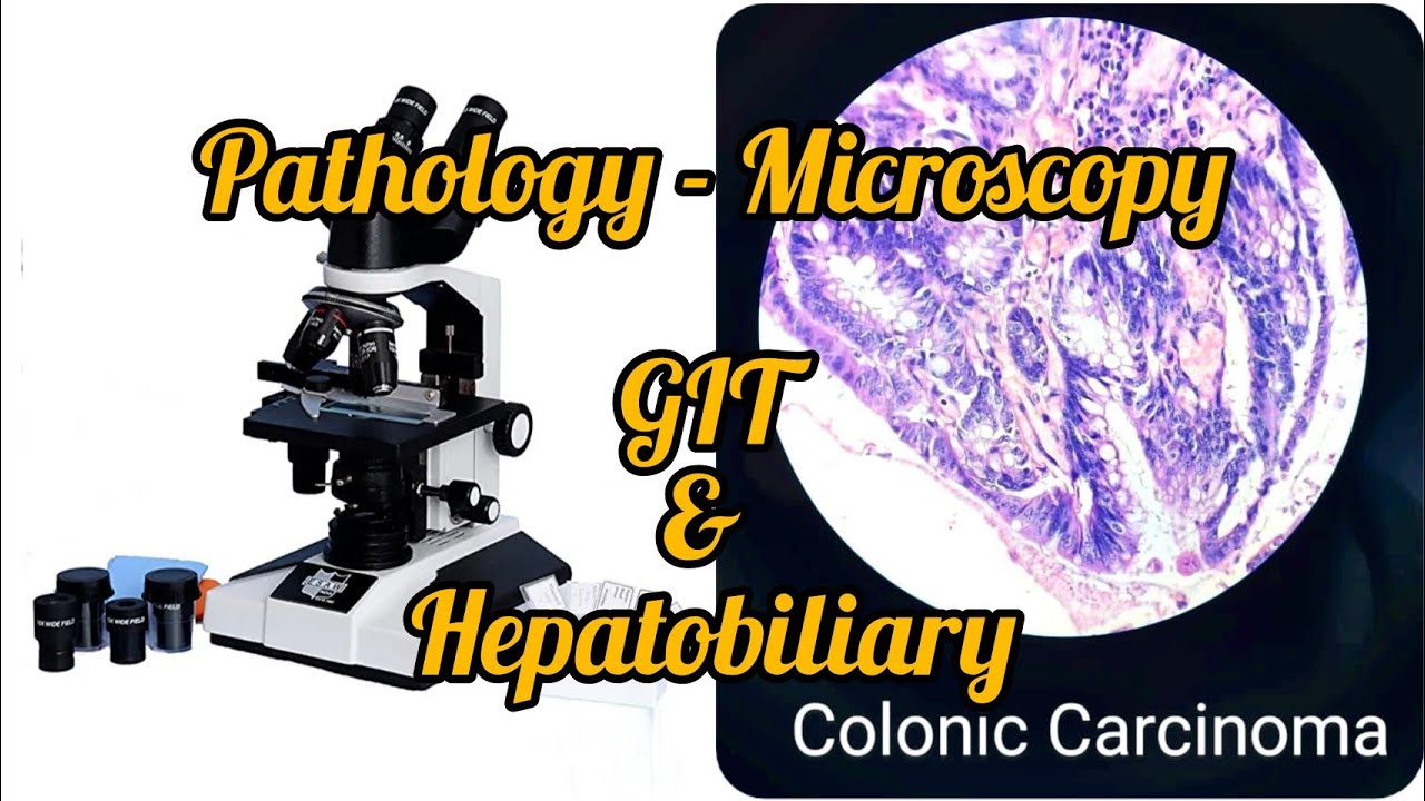 Pathology Microscopy 2nd year MBBS (GIT & Hepatobiliary) - YouTube