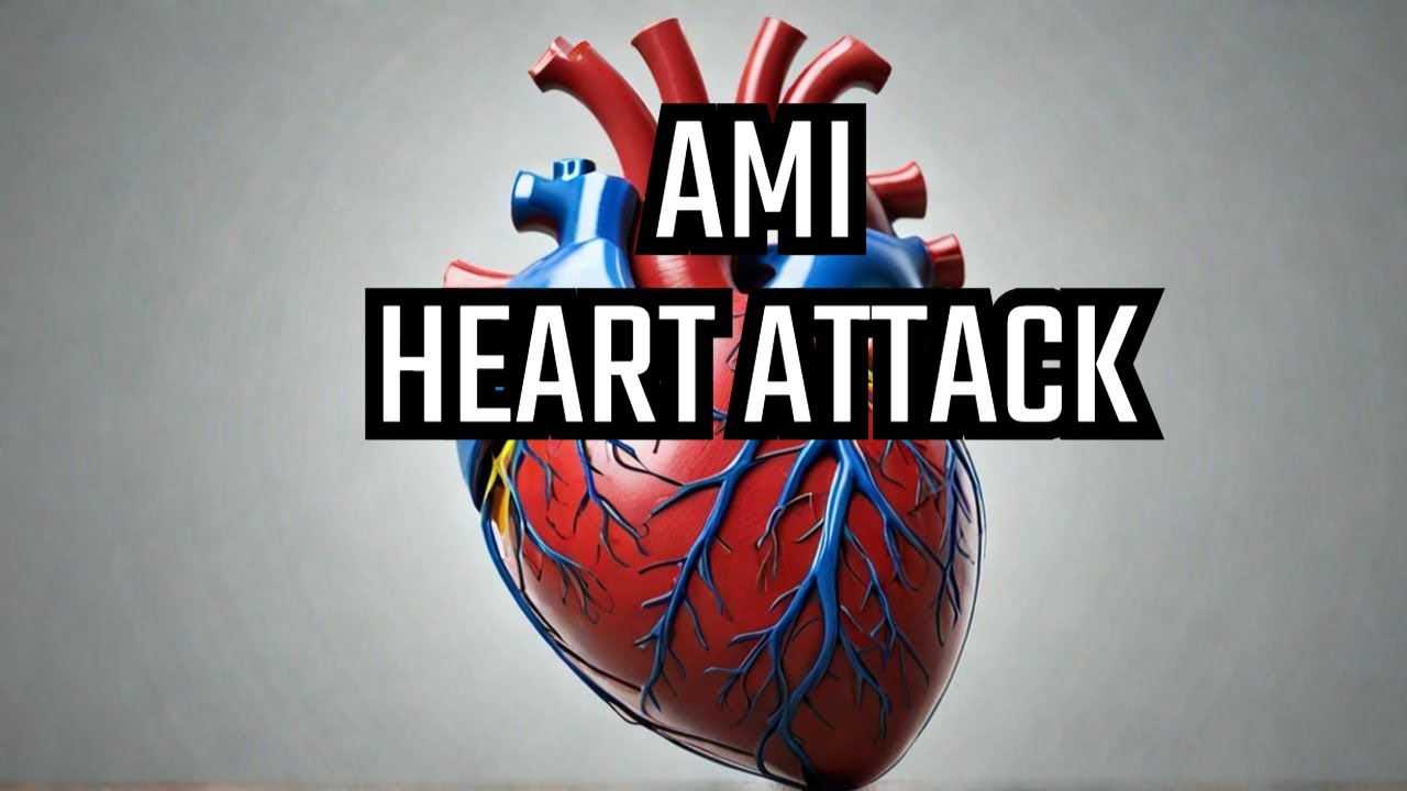 Acute Myocardial Infarction (Heart Attack) – Symptoms, Diagnosis, ECG ...