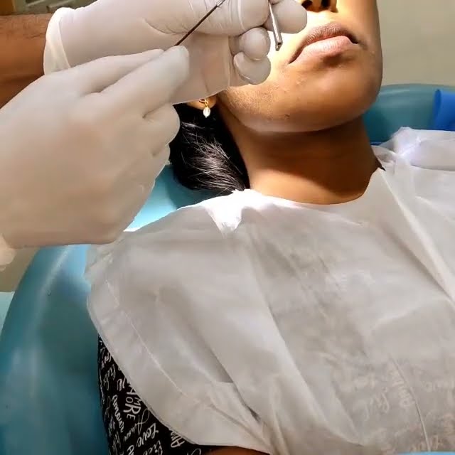 advance sync 2 - YouTube