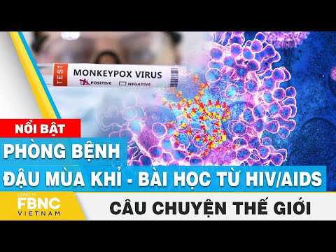 Phòng bệnh đậu mùa khỉ - bài học từ HIV/AIDS | Câu chuyện thế giới | FBNC