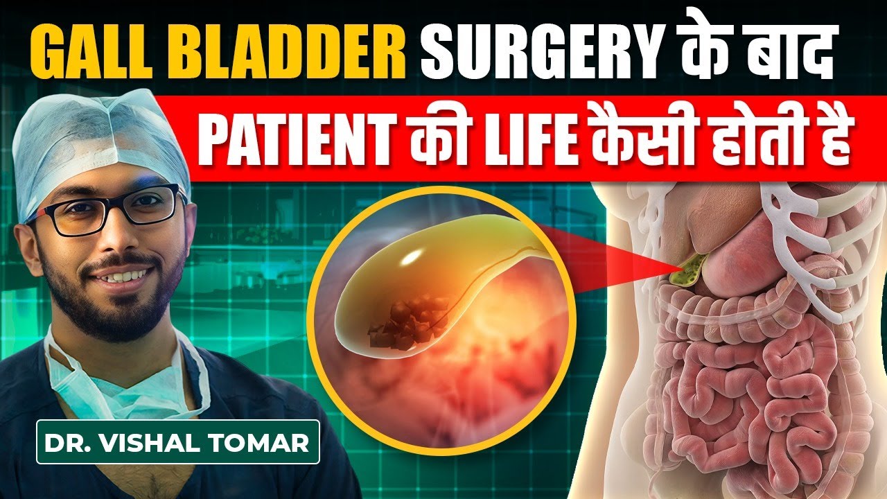 Gall Bladder Operation के बाद क्या करें ? | Life After Gallbladder ...